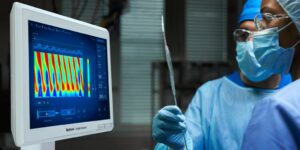 Medtronic’s Endoflip achieves CE Mark helping thousands of patients ...