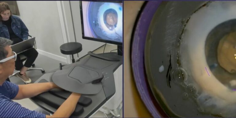 Robotic cataract surgery using ForSight Robotics’ ORYOM platform ...